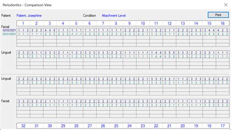 Image result for Axium Perio Chart