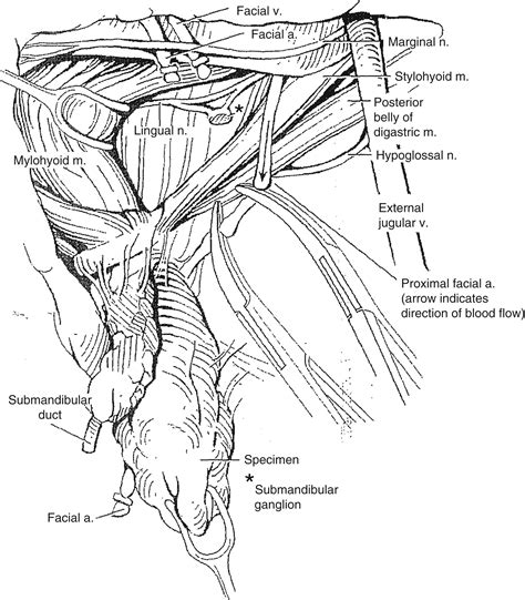 Image result for Types of Neck Dissection