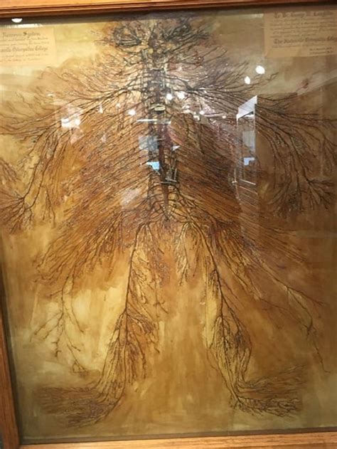 Image result for Nervous System Dissection