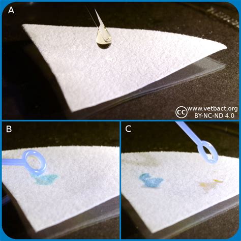 Image result for Indole Test Procedure