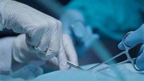 Image result for Hand Surgery Procedure