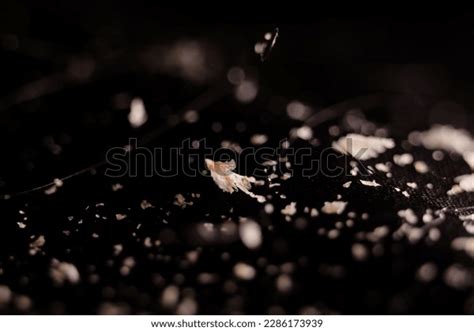 Image result for Seborrheic Dermatitis Contagious