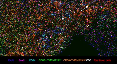 Image result for Tissue Microarray Multiplex IHC NCR