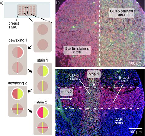 Image result for Tissue Microarray Multiplex IHC NCR