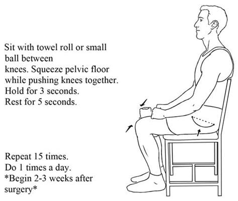 Image result for Exercise After Radical Prostatectomy