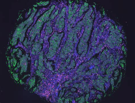 Image result for Multiplex IHC