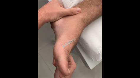 Image result for Chaddock Reflex Video