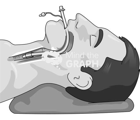 Image result for How to Intubation