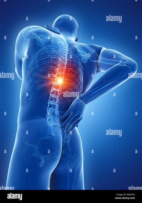 Image result for Back Pain in Computer