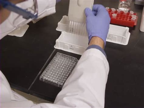 Image result for Estimation of Protein Content Using Elisa