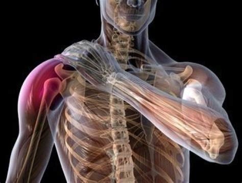 Image result for Shoulder Pain Using Mouse