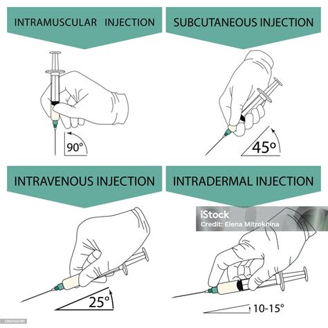 Image result for How to Pierce Injection