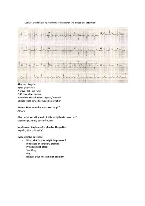Image result for ECG Reading Practice