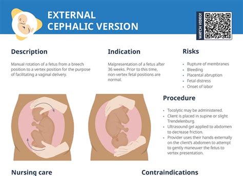 Image result for External Cephalic Version Step by Step