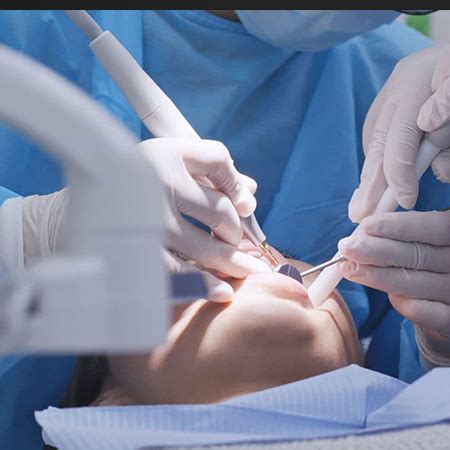 Image result for DIY Teeth Removal