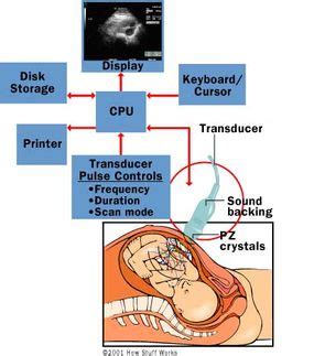 Image result for Ultrasound Machine How It Works