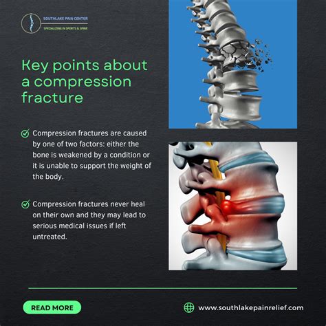 Image result for Surgery for Compression Fracture