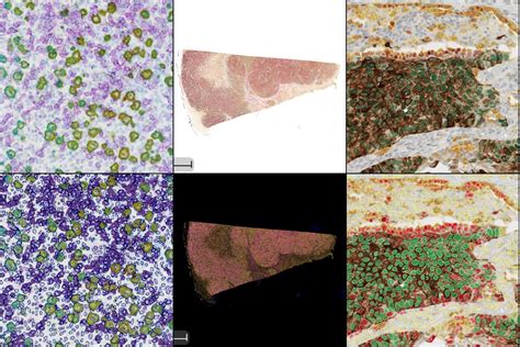 Image result for Multiplex IHC Texture Types Diffuse
