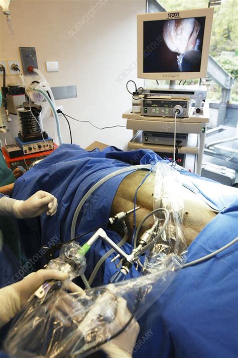 Image result for Veterinary surgery Surgery Types