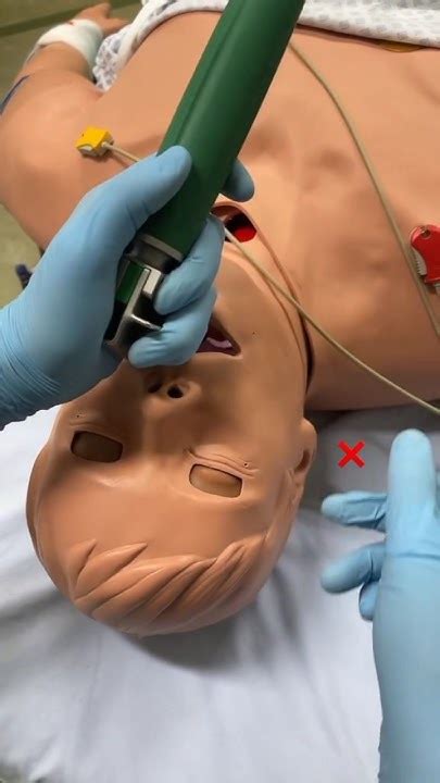 Image result for Intubate Procedure