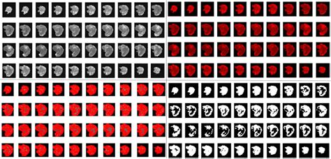 Image result for Sample Image to Implement Homomorphic Filtering for Region Based Segmentation