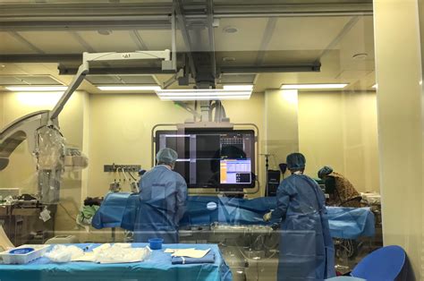 Image result for Embolization Procedure AVM