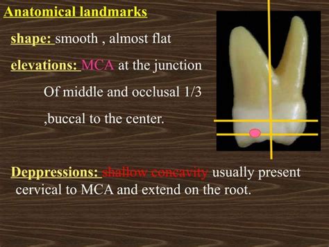 Image result for Maxillary First Molar