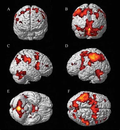 Image result for Python MATLAB Brain Surface