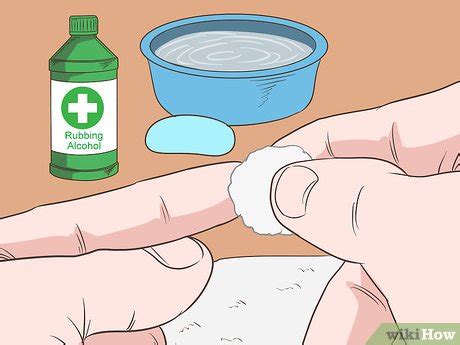 Image result for Deep Splinter Removal