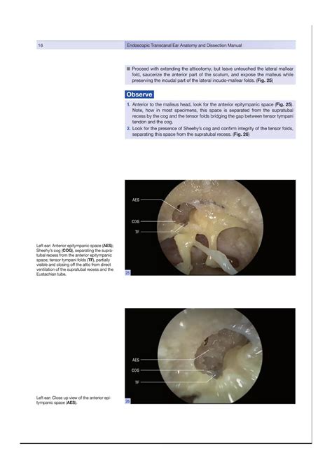 Image result for Ear Dissection