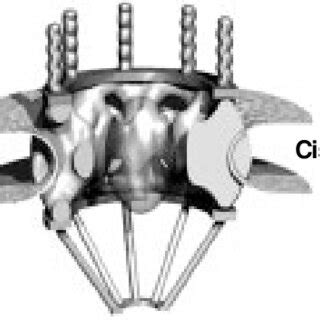 Image result for Model of Nuclear Pore Complex