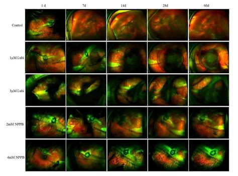 Image result for PVR Formula