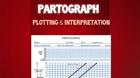 Image result for Normal Partograph