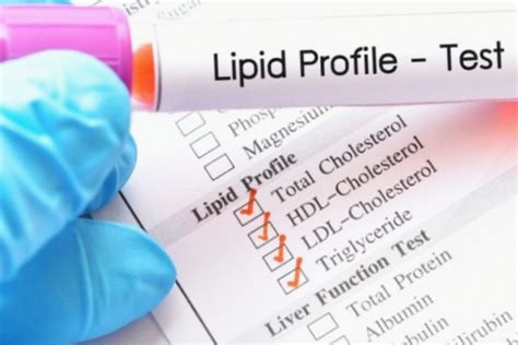 Image result for Lipid Profile Testing