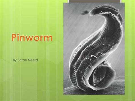 Image result for What Is Pinworm