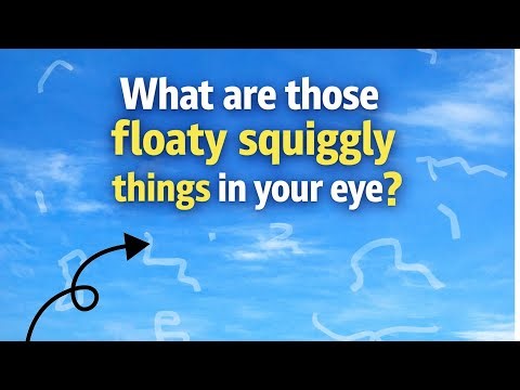 What are those floaty squiggly things in your eye?