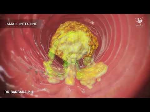 How does your body turn food into the poop Human digestion system in human beings|English subtitle n