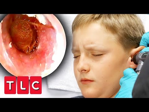 Doctors Warn What Not to Do When a Bug Gets in Your Ear | This Came Out Of Me