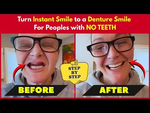 (Step by Step) How to Turn Instant Smile to a Denture Smile for peoples with NO TEETH | Teeth Veneer