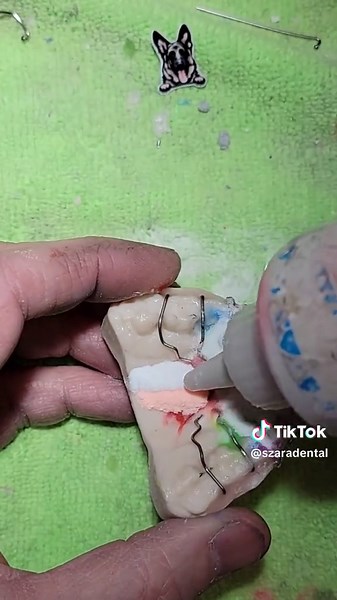 Acrylic Tie-Dye Retainer ASMR Tutorial