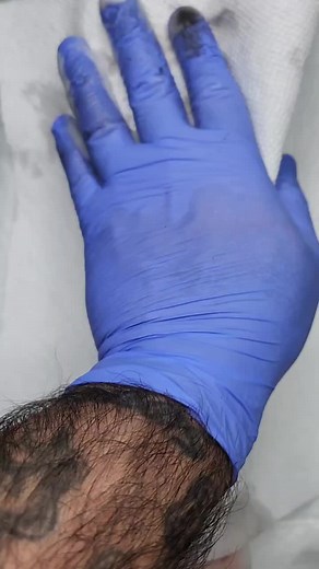 Stunning Solo Night Tattoo Session