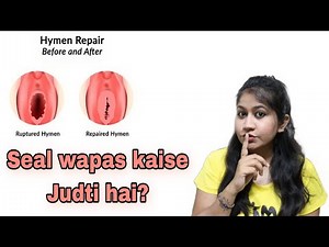 Female's seal reconstruction महिला की सील टूटने के बाद फिर से कैसे जुड़ती है? | Tanushi and family