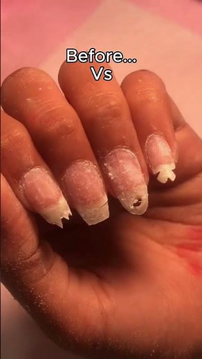 Before and after click on nails 🤯 #nails
