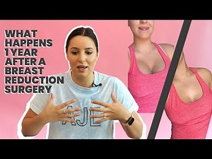 What Happens 1 Year After a Breast Reduction Surgery?