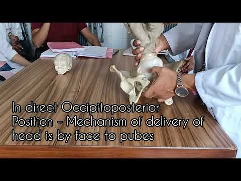 Occipito Posterior Position - Mechanism of Labour - By Love Obstetrics & Gynecology
