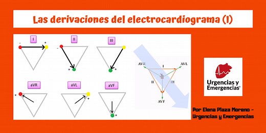 ❤️‍🔥 Derivaciones del electrocardiograma: precordiales y de los miembros