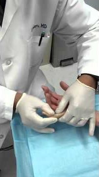 Treating Dupuytren's Contracture: Xiaflex (2nd Stage) w/ Dr. Sohel Islam at Advanced Specialty Care