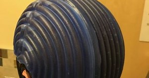 Cancer survivor's cold cap prevents hair loss