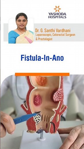 Fistula-In-Ano Treatment by Dr. G. Santhi Vardhani – Expert Colorectal & Proctology Care