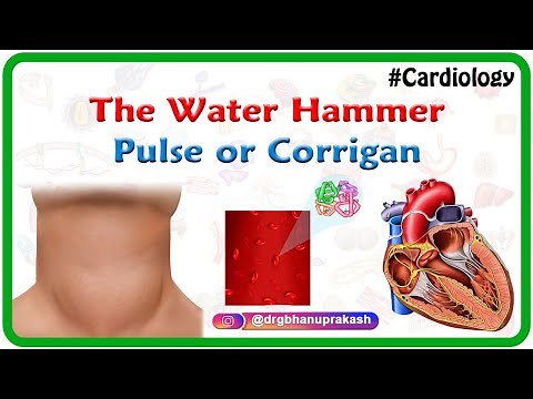 The water hammer pulse or Corrigan (hyperkinetic) pulse || #usmle cardiology